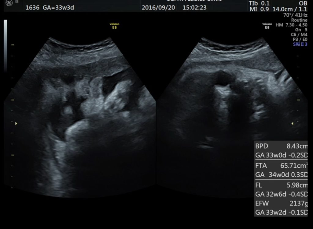 33W3D | miz*nagiブログ