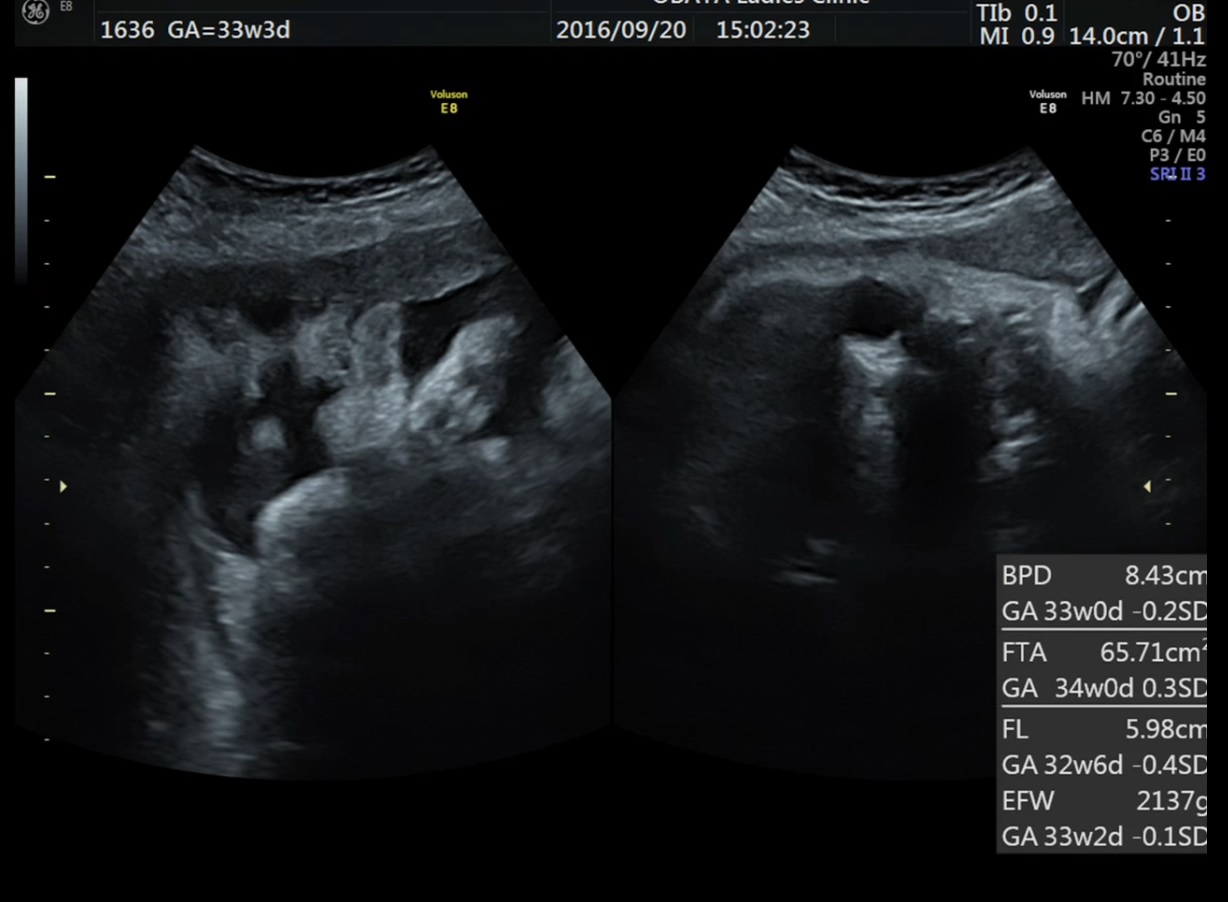 33W3D | miz*nagiブログ