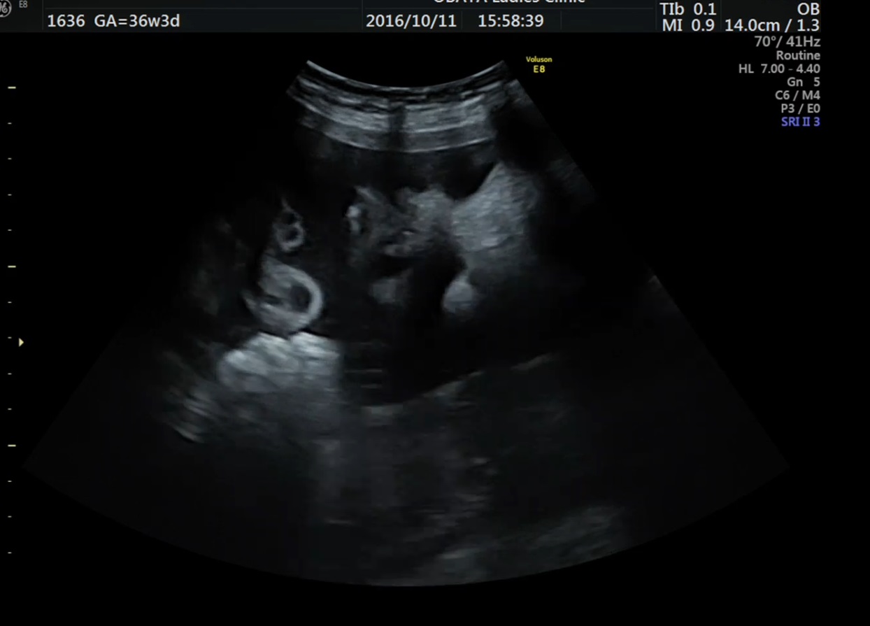 36w3d | miz*nagiブログ