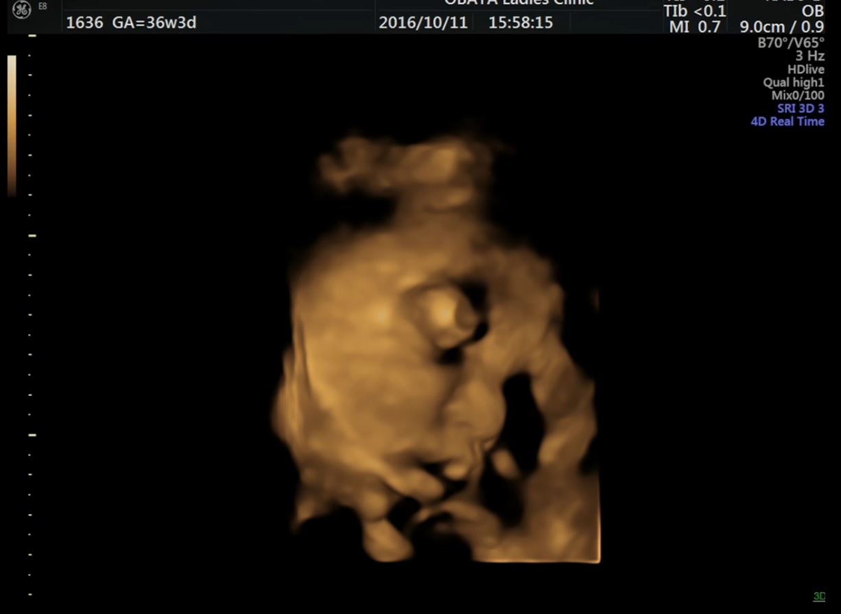 36w3d | miz*nagiブログ